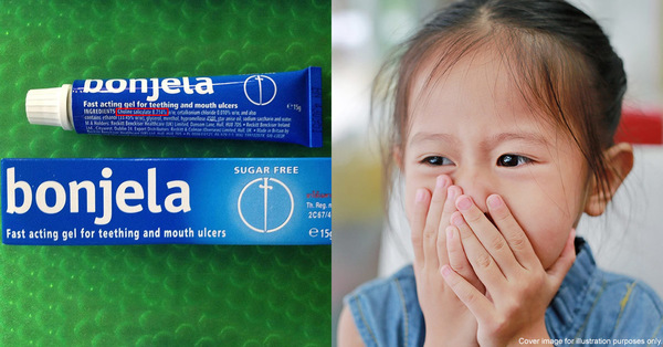PSA: Ulcer Gels Like Bonjela Should Not Be Used In Children Below 16 ...